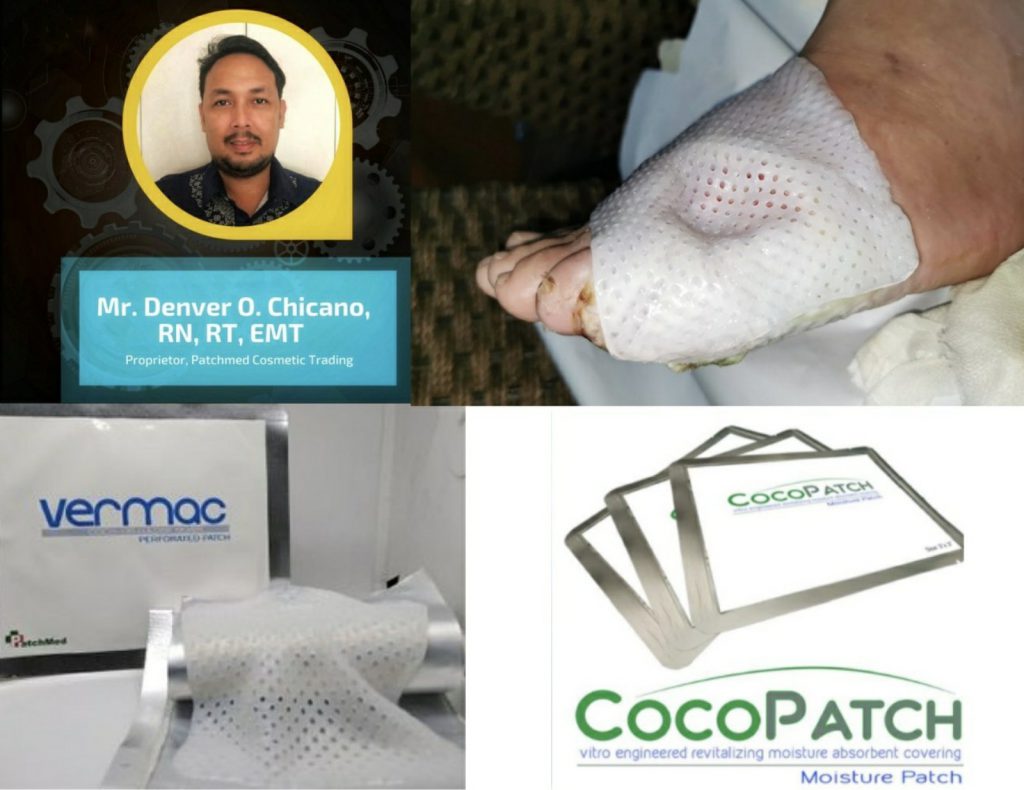 Filipino nurse develops 'wonder patch' from coconut for the wounds of ...